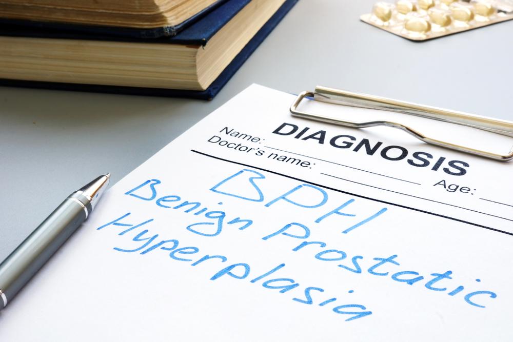 How Is BPH Diagnosed? | Tampa Urology
